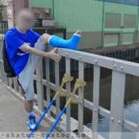 Tutorial - How to make a Toeplate on a Leg Cast - The Gay-Skater-Caster